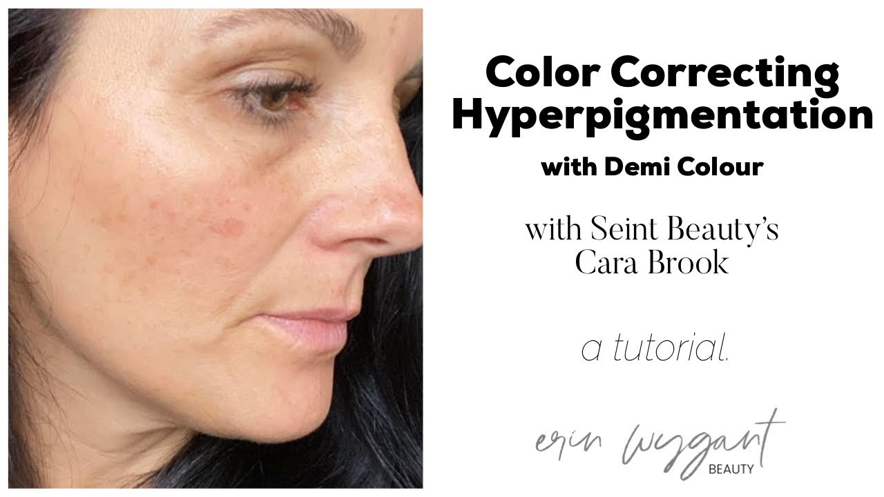 Color Correcting Hyperpigmentation using Demi Colour - YouTube
