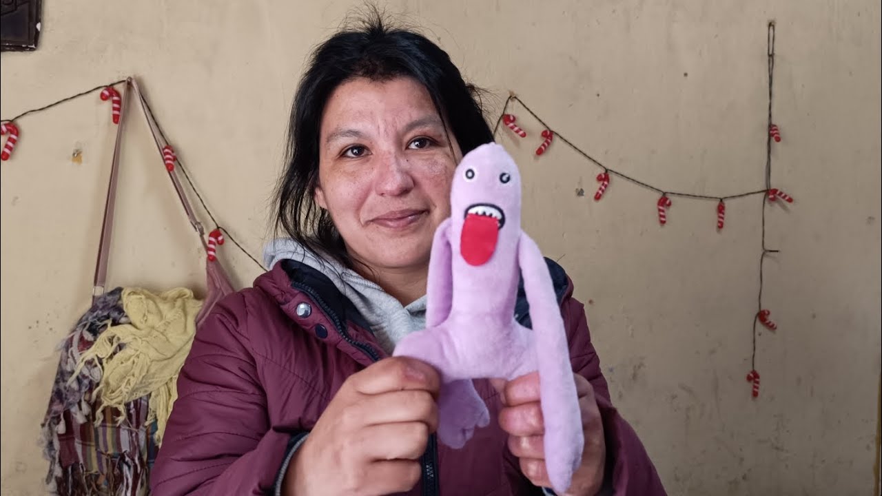 "PRINCESA EMA" Madre busca hogar para niña con quemaduras - YouTube