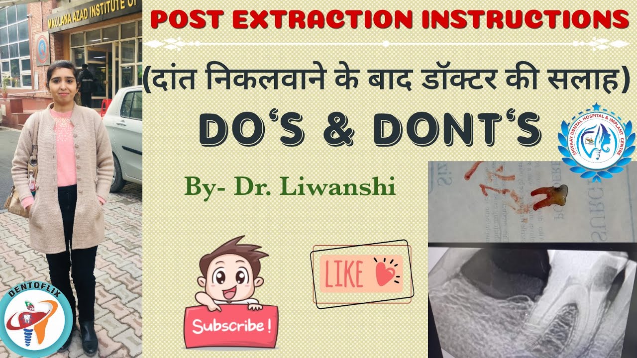 दांत निकलने के बाद डॉक्टर की सलाह | Post Extraction Instructions । दांत ...