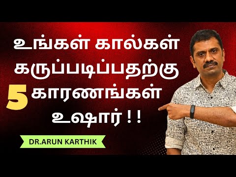 உஷார்! கால்கள் கருப்படிப்பதற்கு 5 முக்கிய காரணங்கள் |TOP REASONS FOR BLACKENING OF LEGS  |TREATMENT