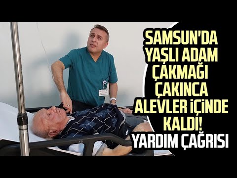 Samsun'da yaşlı adam çakmağı çakınca alevler içinde kaldı! Yardım çağrısı