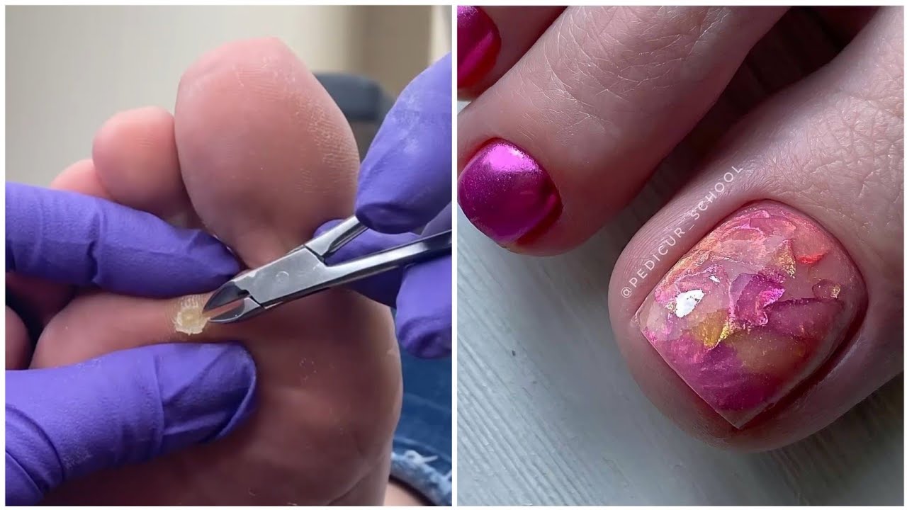 Most Satisfying Pedicure Transformation 😱 best nail polish for toes ...