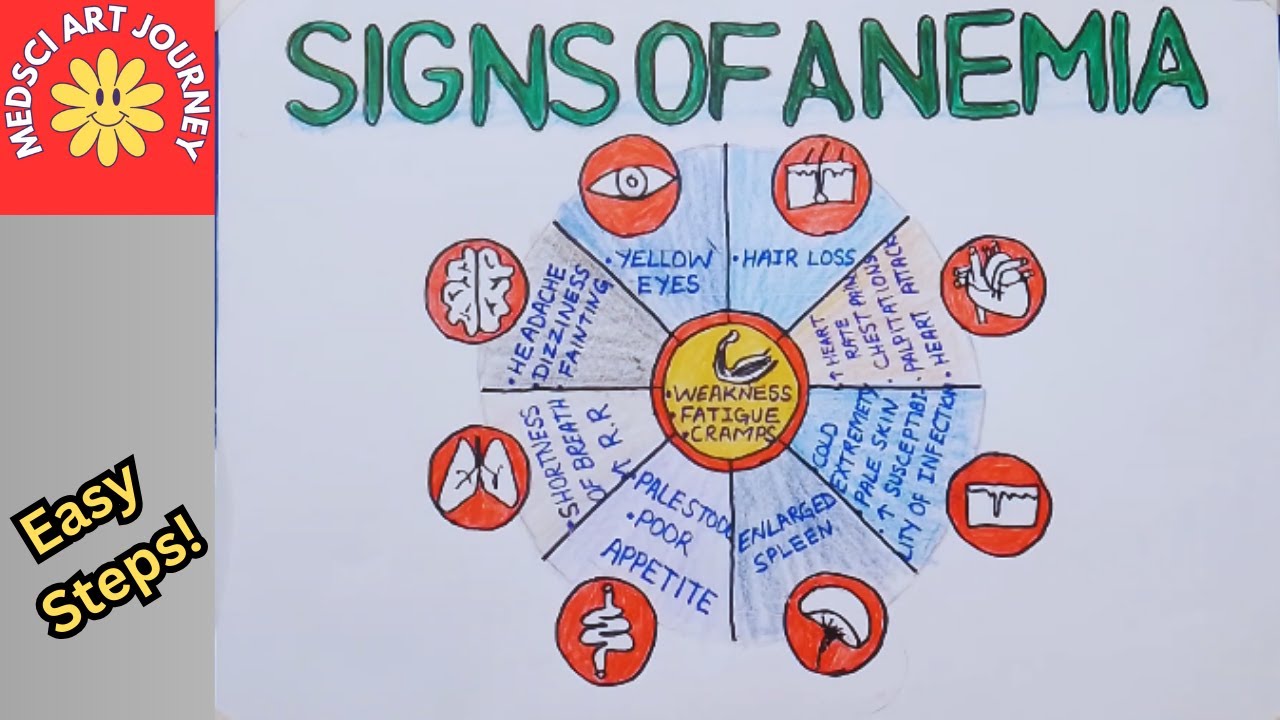 Common Signs of Anemia Explained/ Medical Drawing for Biology, Science ...