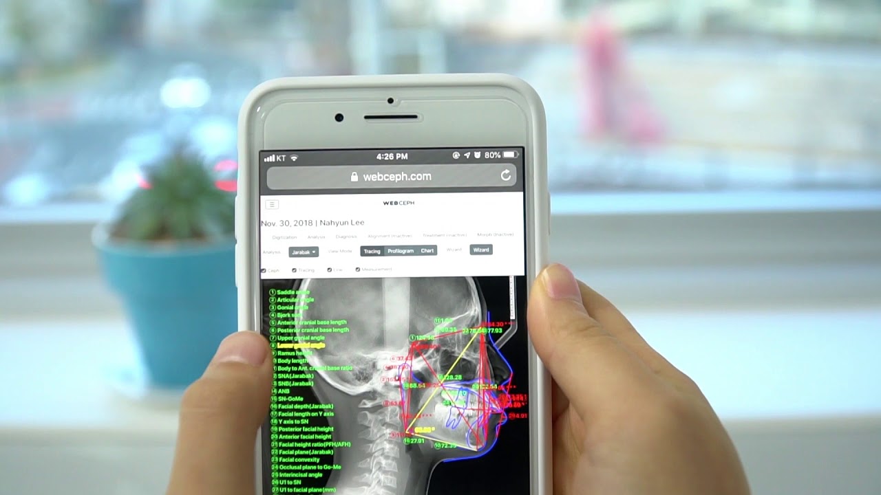 WebCeph: A.I. Cephalometric Analysis Software - YouTube