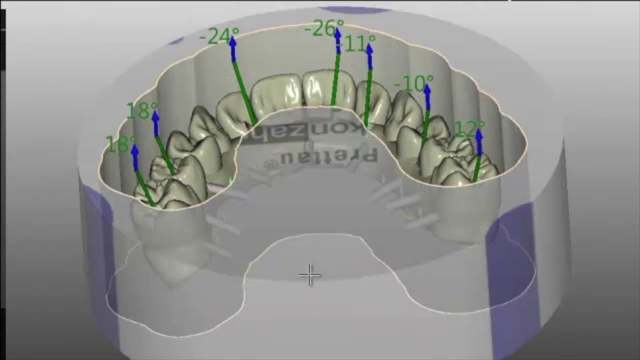 Nesting Zircone Bridge - YouTube