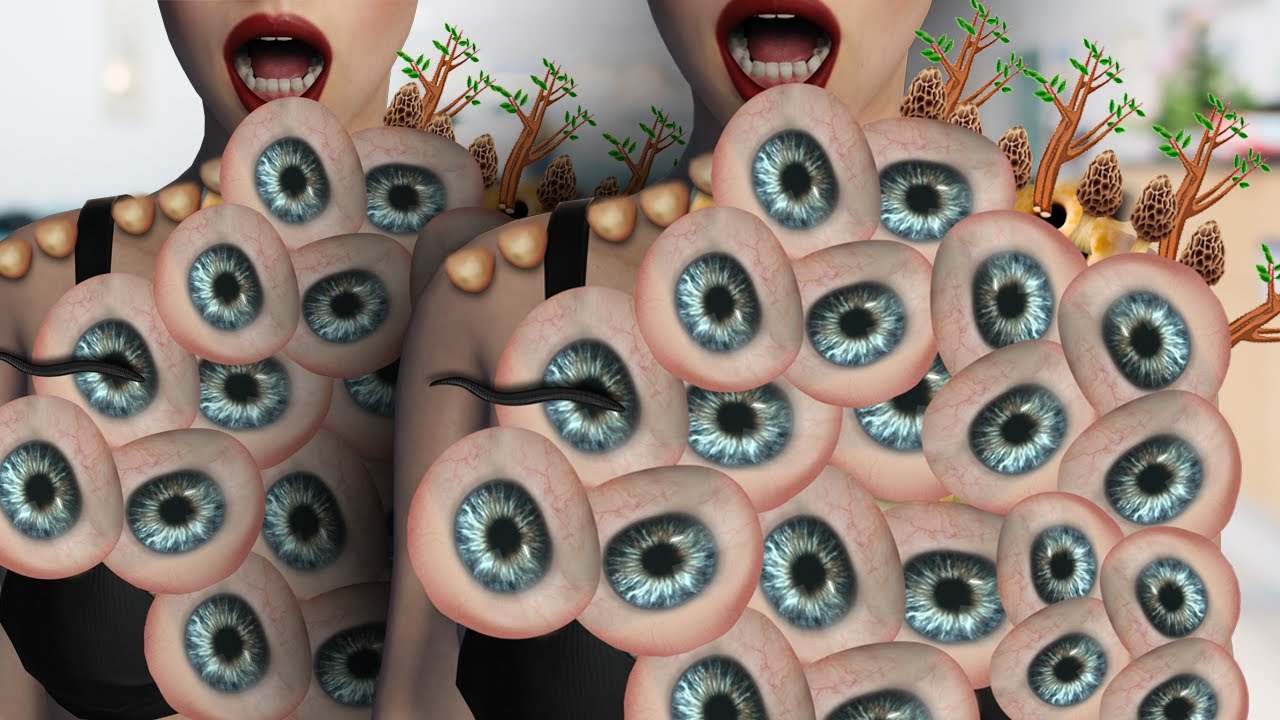 ASMr Removal Dog Ticks & Trypophobia Infected Chest | Severely Injured ...