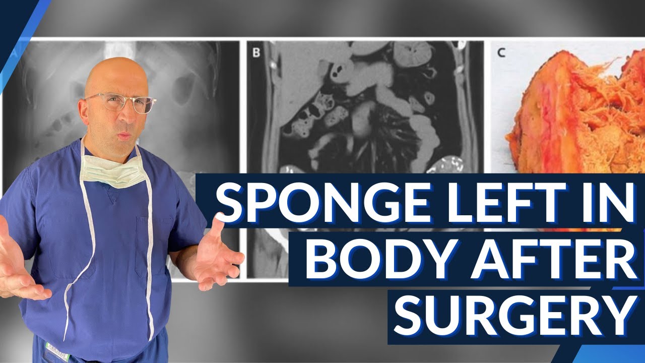 Sponge Left In Body Following Surgery - YouTube