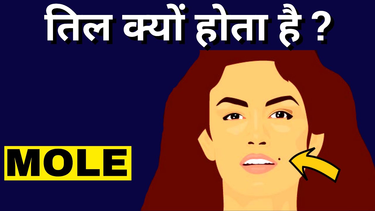 Why Mole Come On Face | How Moles Are Formed | How Mole Is Formed In ...