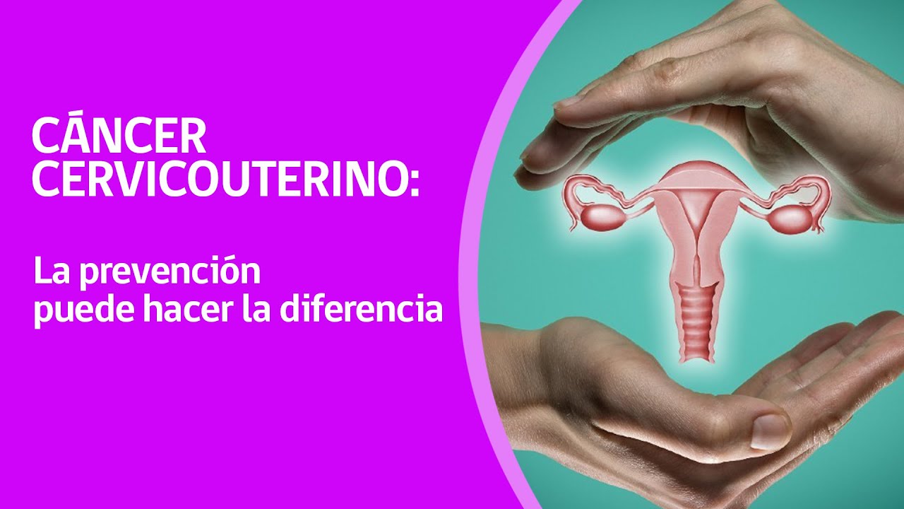 Cáncer cervicouterino: La prevención puede hacer la diferencia - YouTube