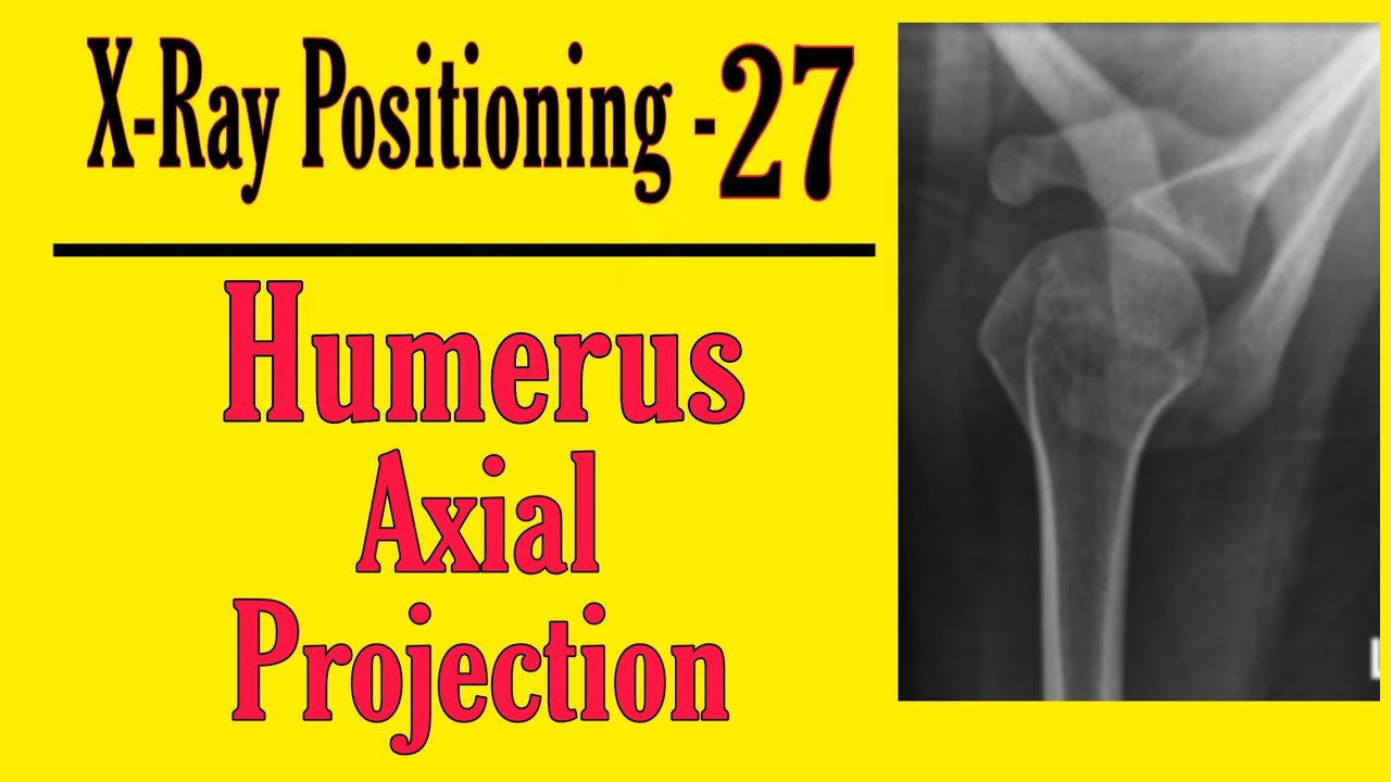 HUMERUS AXIAL POSITIONING HINDI | X RAY POSITIONING FOR RADIOGRAPHERS ...