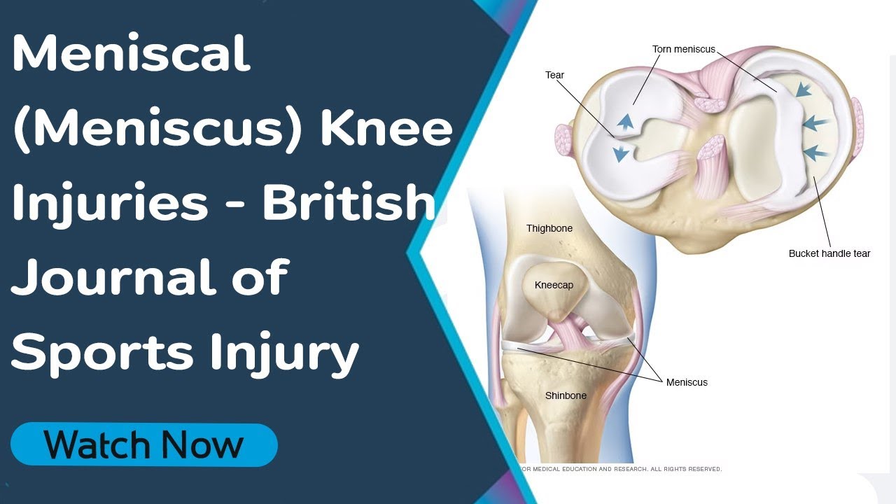 Meniscal (Meniscus) Knee Injuries - British Journal of Sports Injury ...