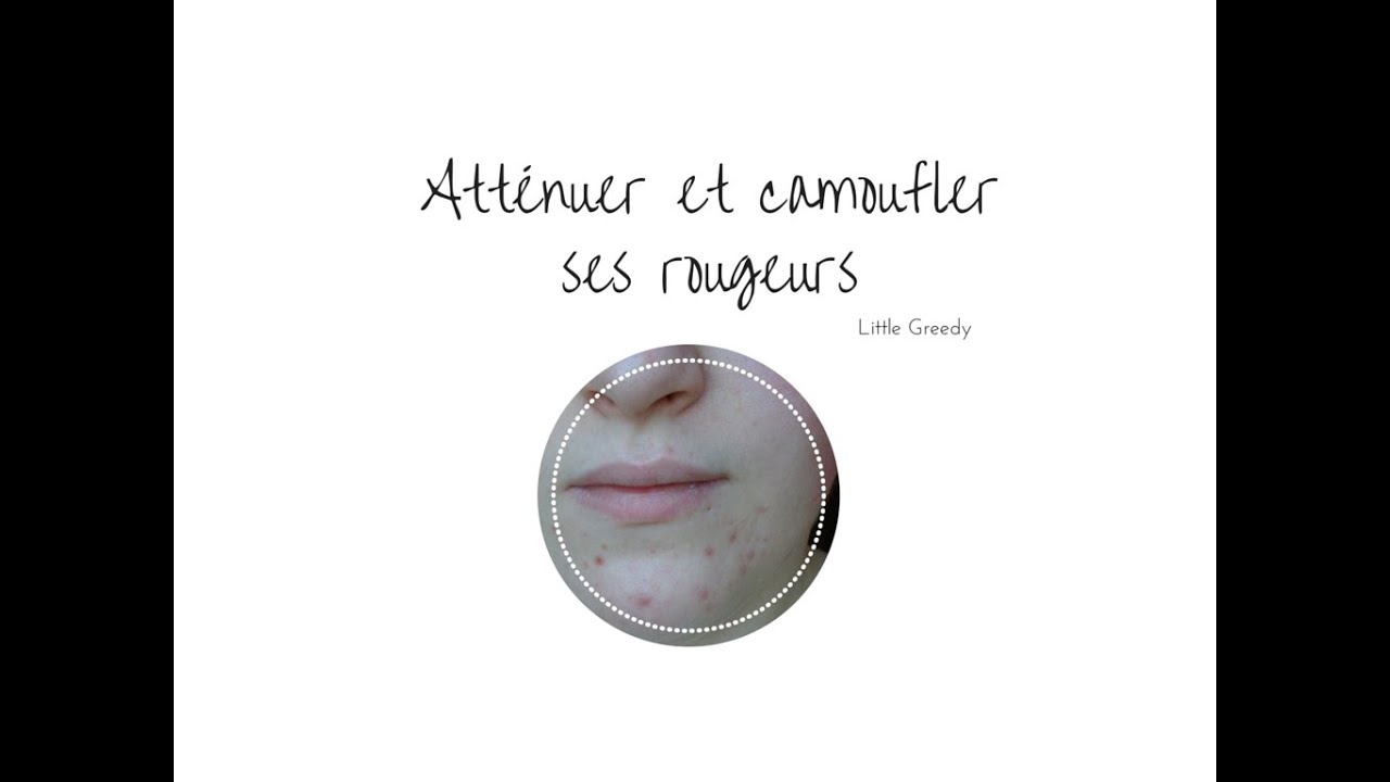 Atténuer ses rougeurs et imperfections - ASTUCES - YouTube