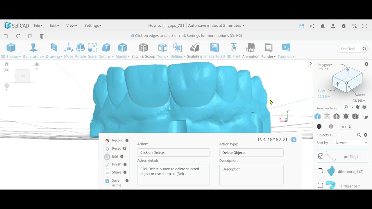 How to carve perfect margins on 3D scanner teeth. A live tutorial ...
