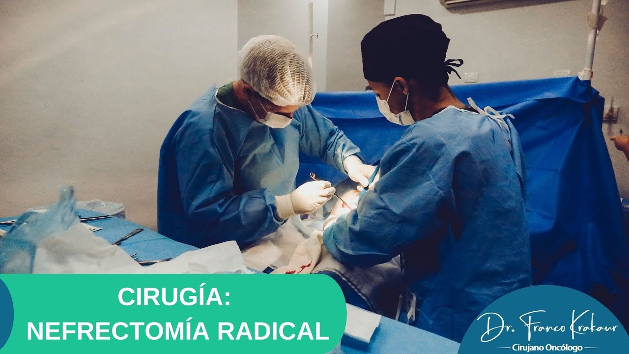 Cirugía Nefrectomía Radical / Dr. Franco Krakaur/ Cirujano Oncólogo ...