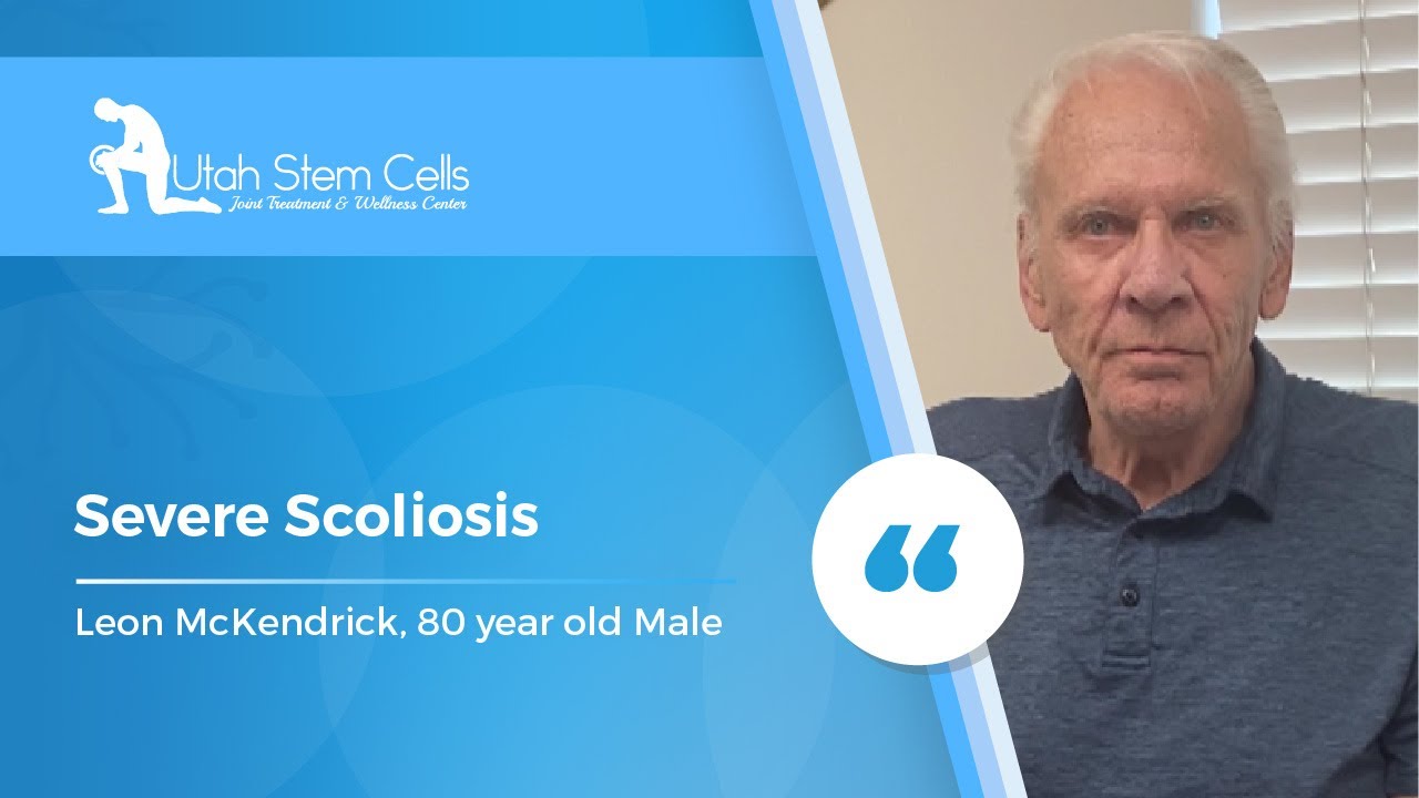 Severe Scoliosis - Utah Stem Cells - YouTube