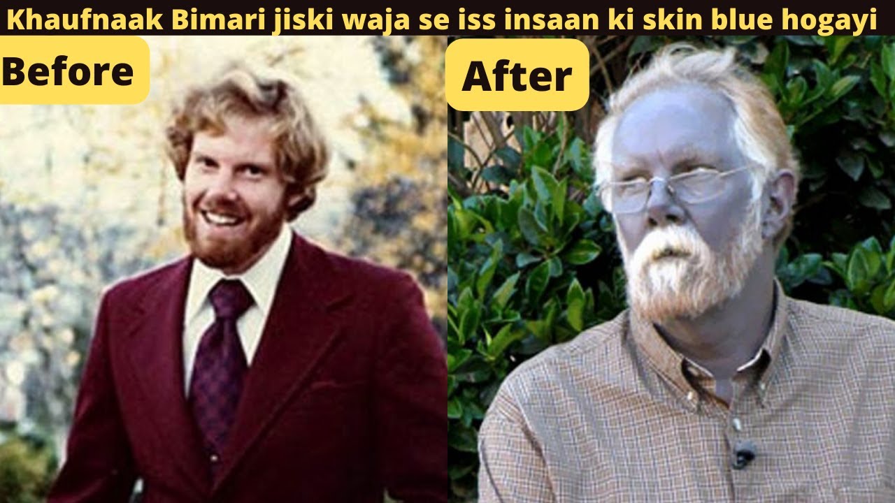 Most Unique and Unusual People in The World | Unique People Who Shocked ...