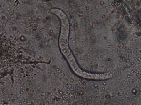 Strongyloides stercoralis (threadworm)-hpf - YouTube