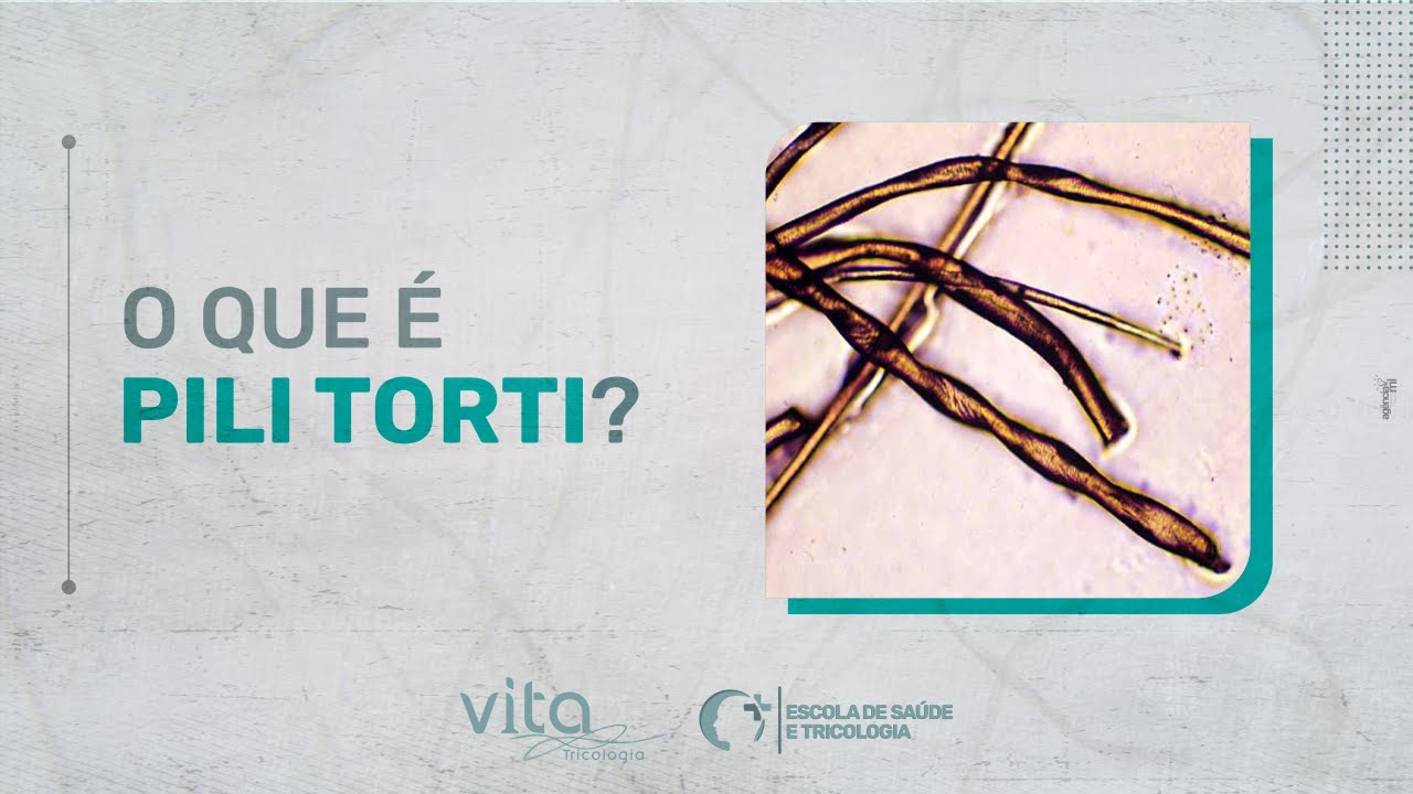 Pili Torti ou Pelo Torcido | Vita Tricologia - YouTube