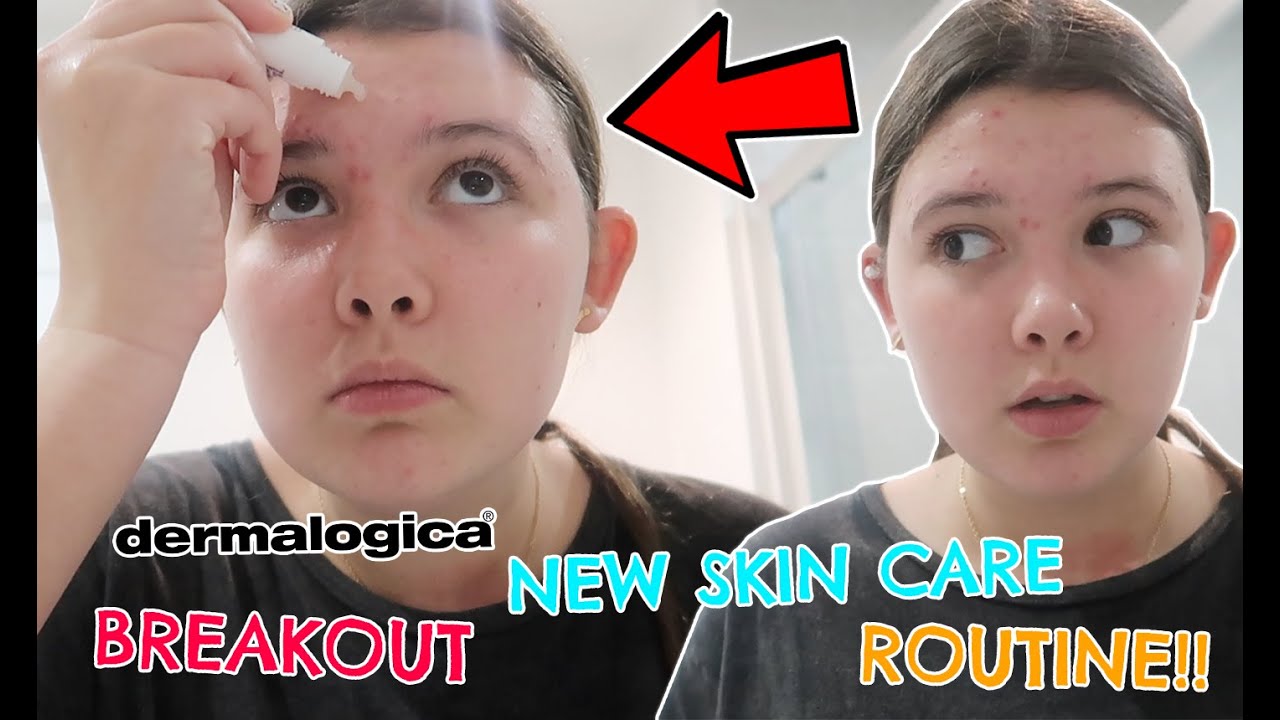 TEEN SKIN BREAKOUT - NEW SKIN CARE ROUTINE!! - YouTube