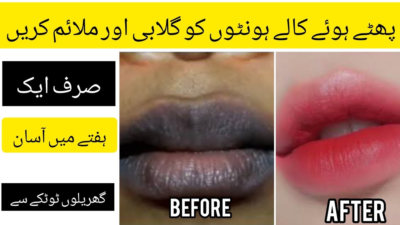 how to get baby pink lips naturally homemade remedy. turn your black ...