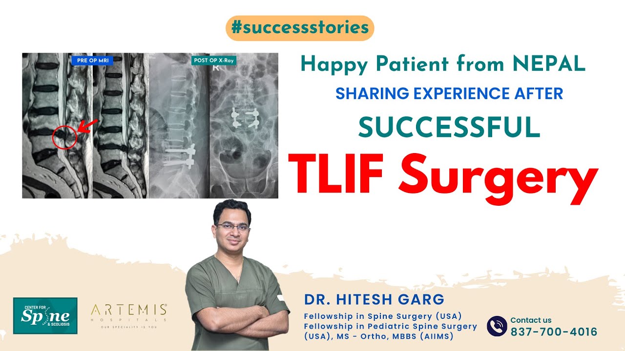 Happy Patient from Nepal sharing experience after TLIF surgery | Lumber ...