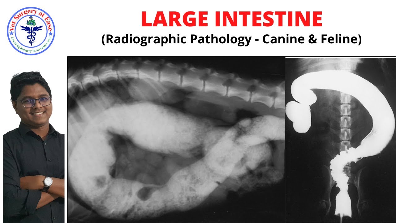 Large Intestine | Radiology | Lecture 08 - YouTube