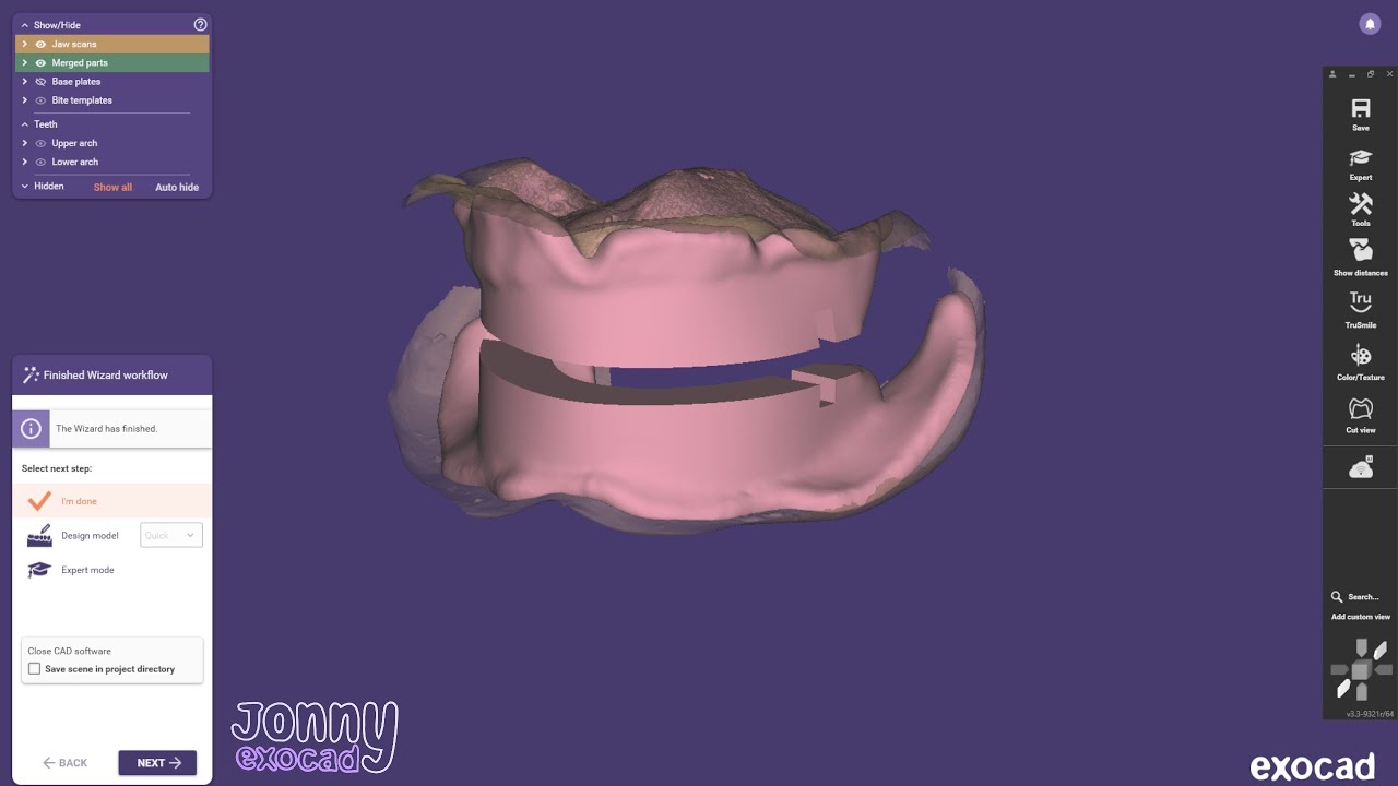 Exocad 3.3 Bite Template Tutorial | Digital Base Plate & Wax Rim Design ...