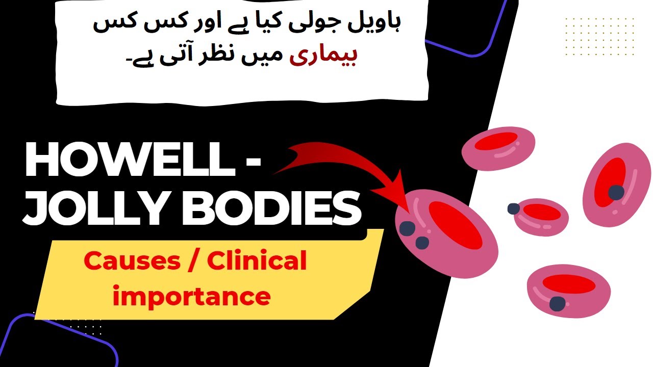 Howell jolly Bodies Causes | Howell jolly bodies vs heinz bodies ...