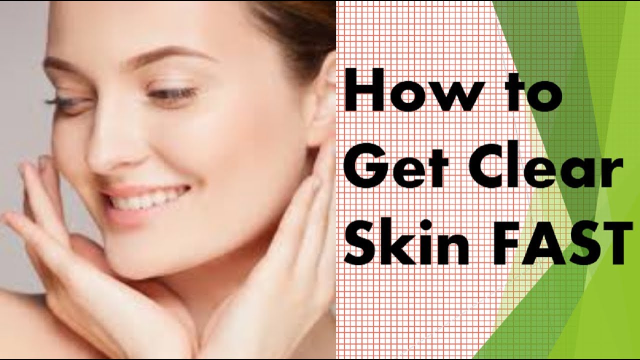 How to Get Clear Skin FAST | 4 Simple Tips to Get Clear Skin | Get ...
