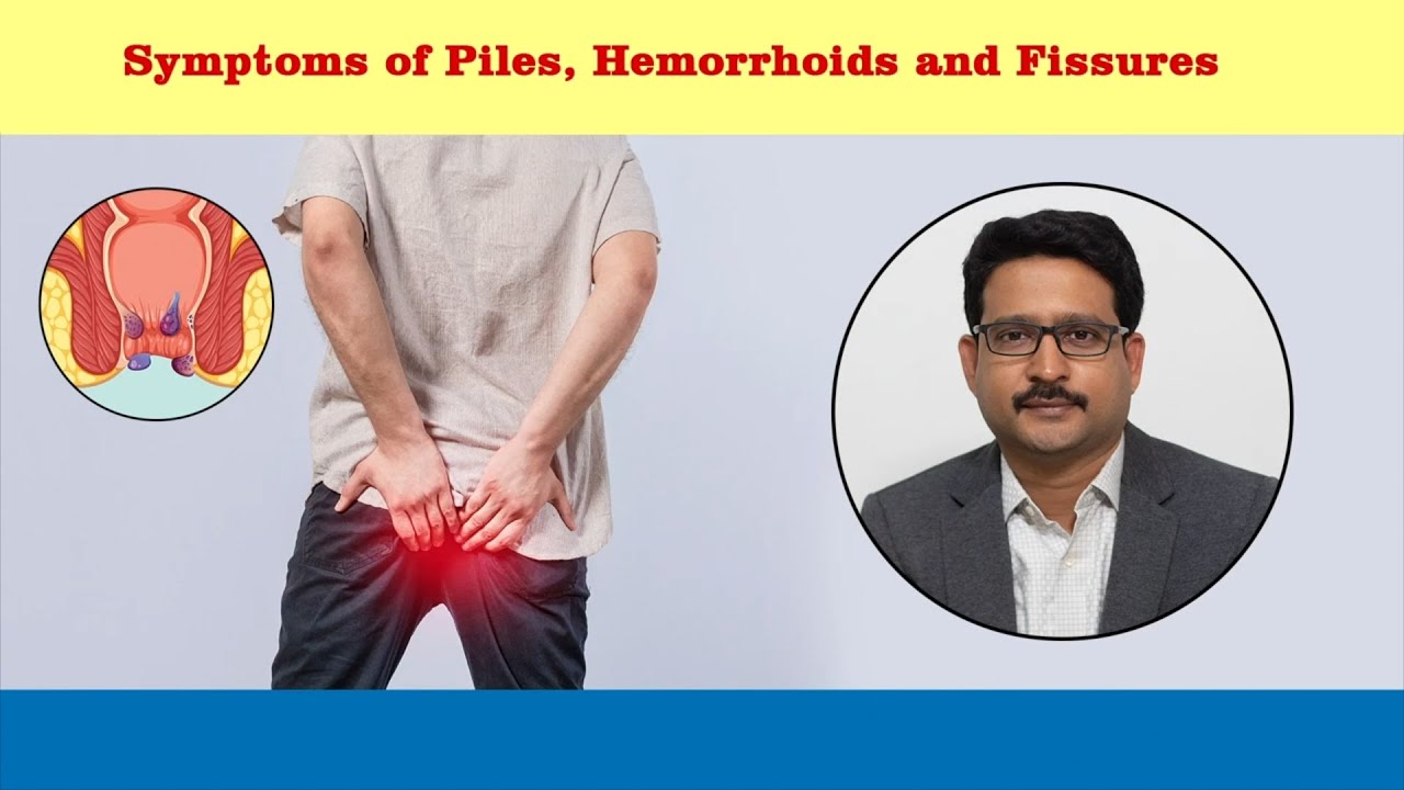 Understanding differences and symptoms of Piles, Hemorrhoids, and ...