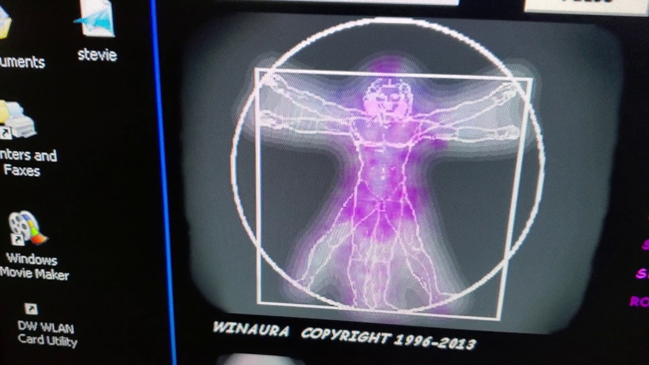 The Aura Imaging Machine at Kuadra - YouTube