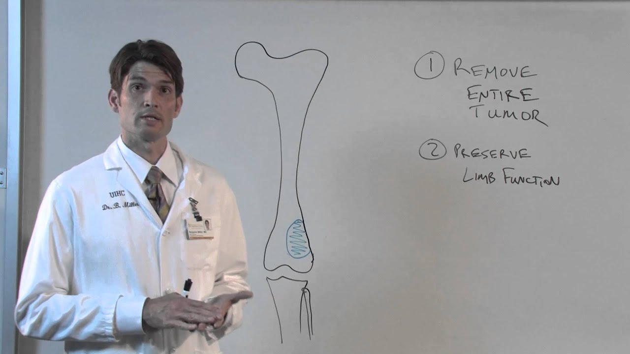 Limb Salvage Surgery for Bone Sarcoma - Ben Miller, MD - YouTube
