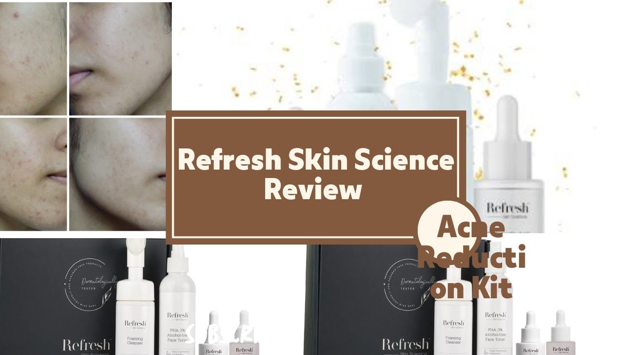 Refresh Skin Science Review|Acne Reduction Kit|Acne Free Skin|Honest ...