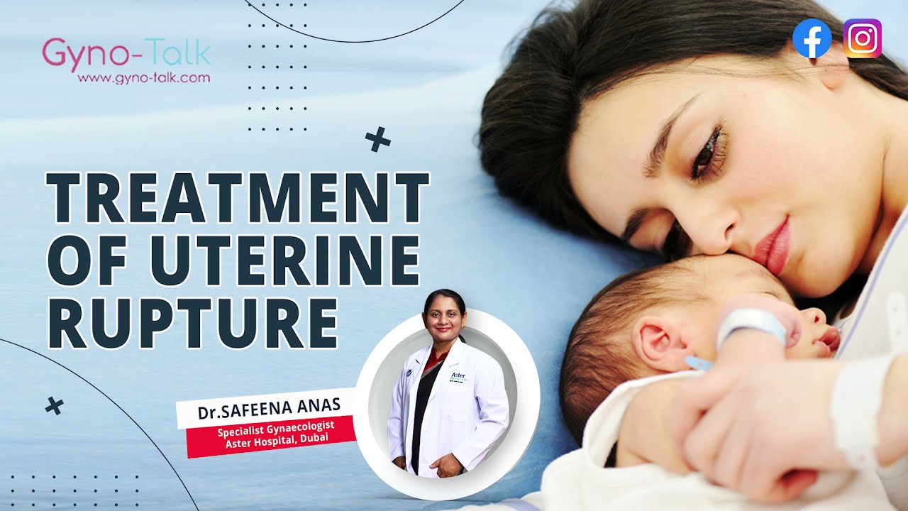 Uterine Rupture | Treatment | How to treat uterine rupture | Dr Safeena ...