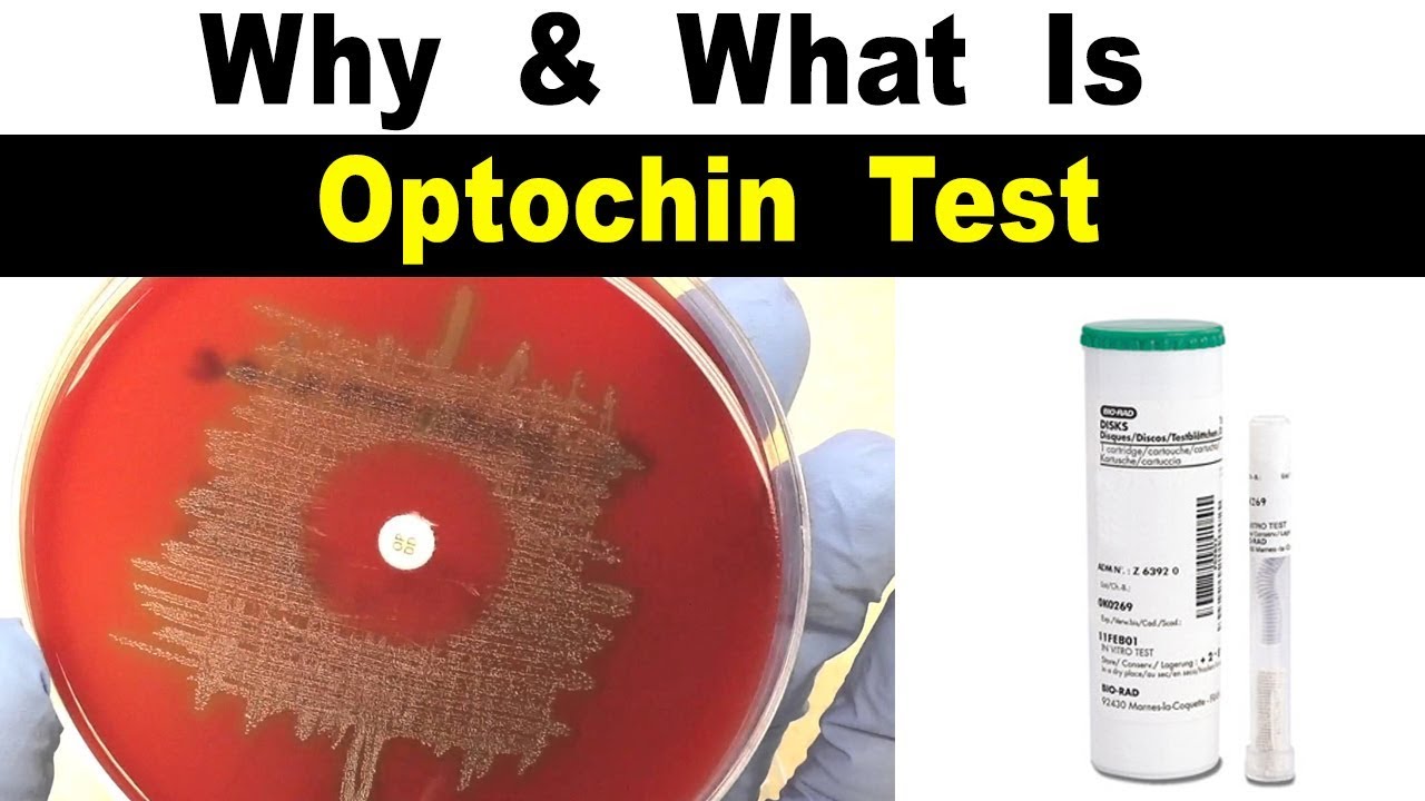 Why & What is Optochin Disk Test ? ( Clear Explain ) - YouTube Music