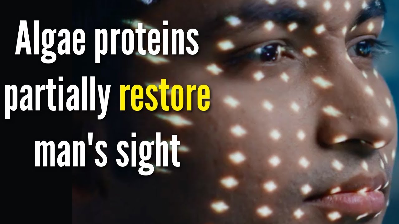 For the First Time, Optogenetic Therapy Partially Restores Patient’s ...