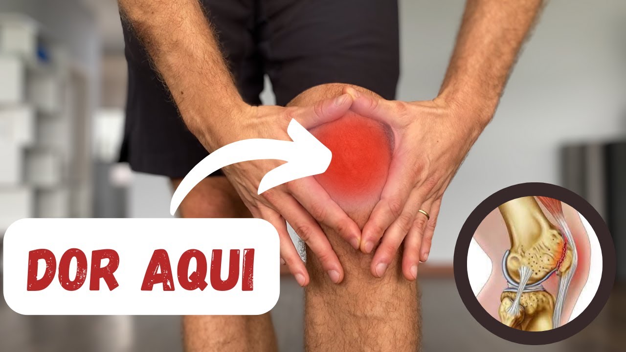Dor Patelofemoral | Condromalácia Patelar | Joelho de Corredor (Mitos ...