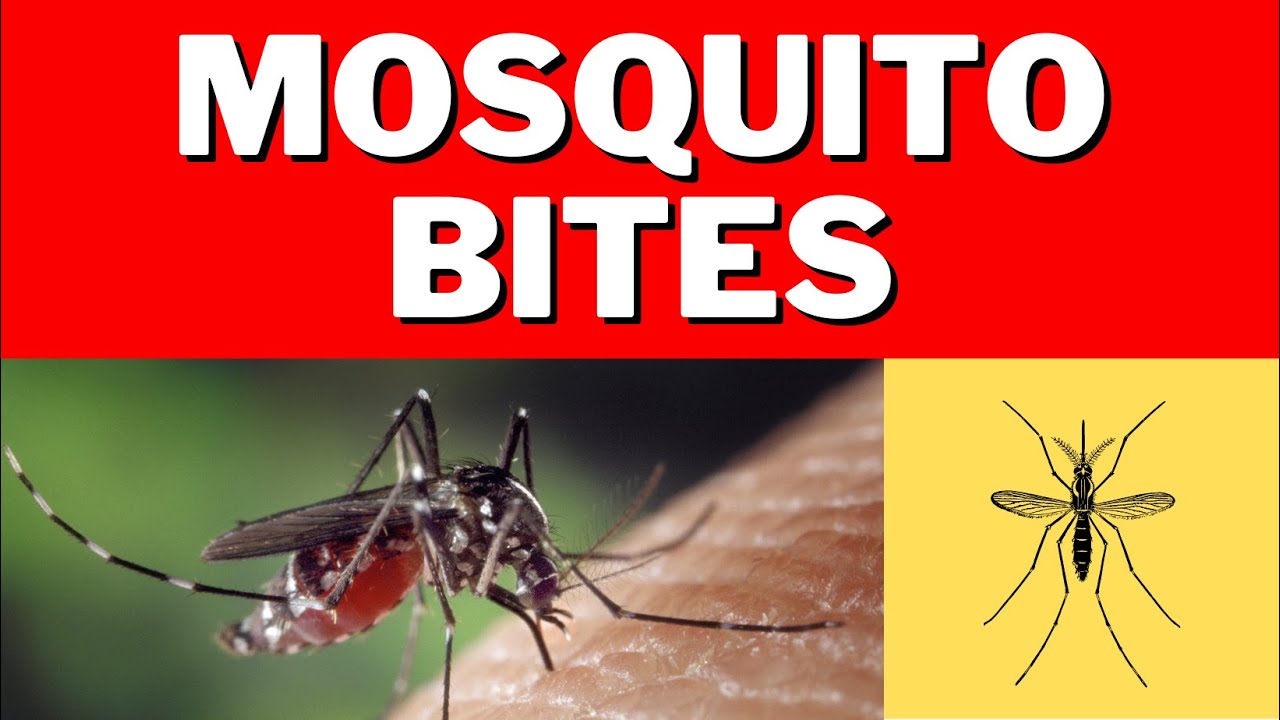 Stop the Itch: How To Get Rid Of Mosquito Bites - YouTube
