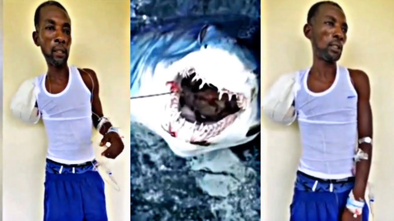 Watch how shark b!te 0ff man arm & hand in jamaica he lives to tell the ...