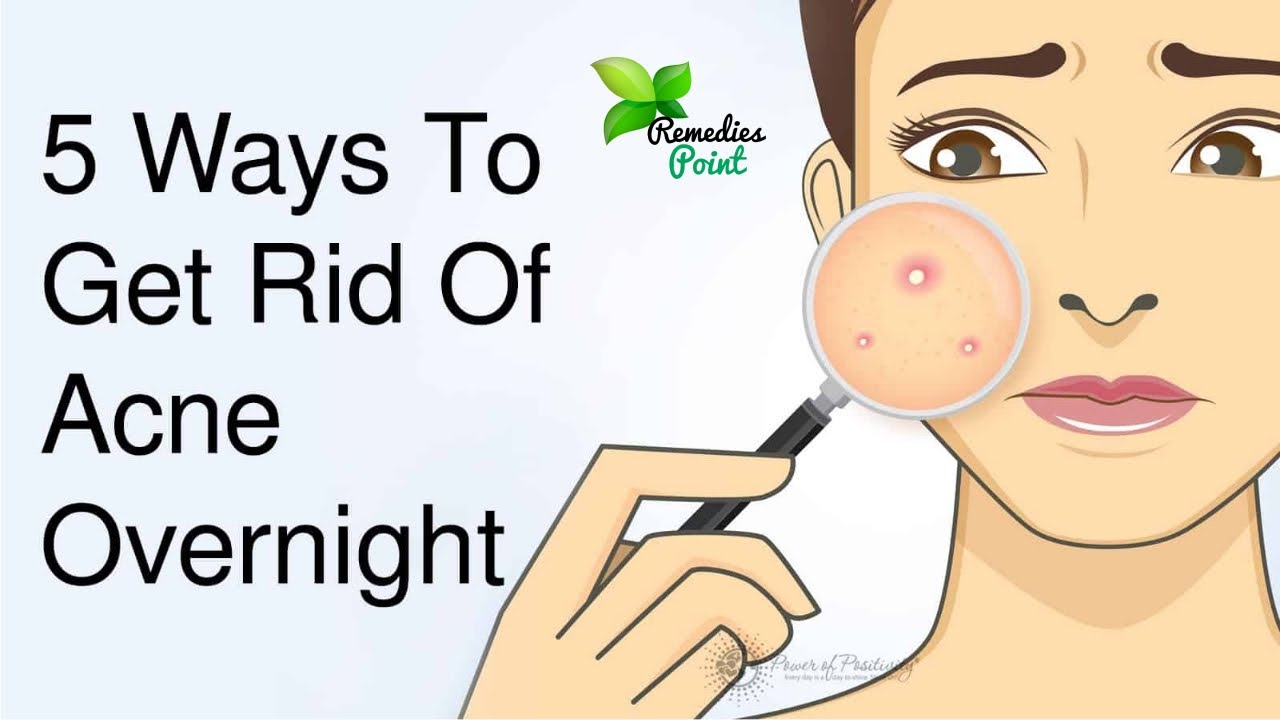 How to get rid of Pimples Home remedies| Acne Treatment | Top 5 Ways to ...