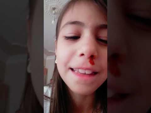 Burun kanama şakası