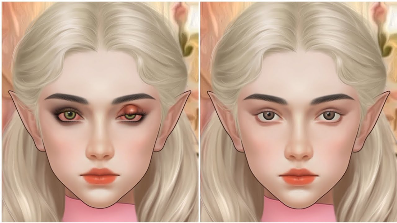 ASMR eye infections I| Rheum deep cleaning || Squeeze eyes acne ...