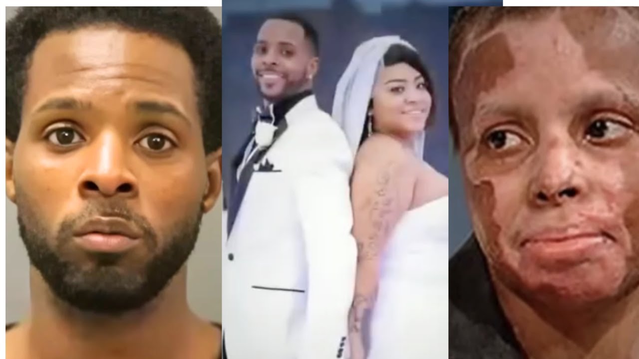 Chicago Woman Bride Burned Alive by DL Husband After Dream Wedding ...