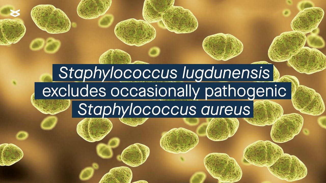 Staphylococcus lugdunensis competitively excludes occasionally ...
