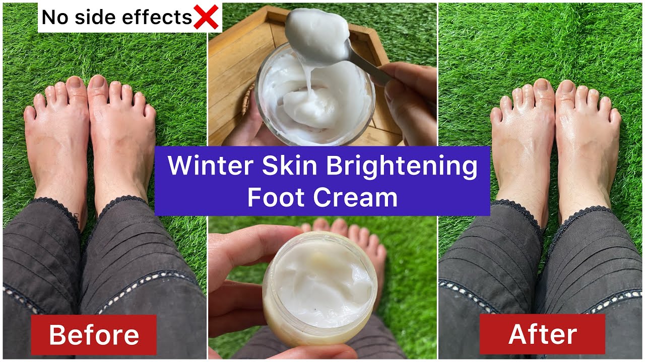 Make Your Own Foot Whitening Cream For Bright.Soft & Beautiful Feet ...