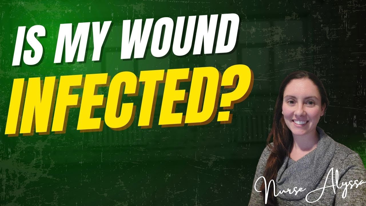 Signs of Wound Infection: Red Flags You Must Know - YouTube