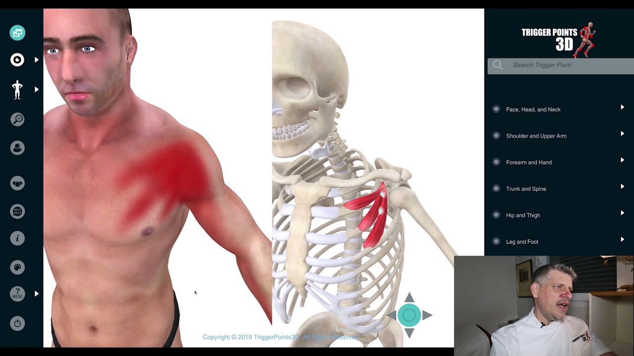 Pec Minor - Trigger Point of the Week - YouTube