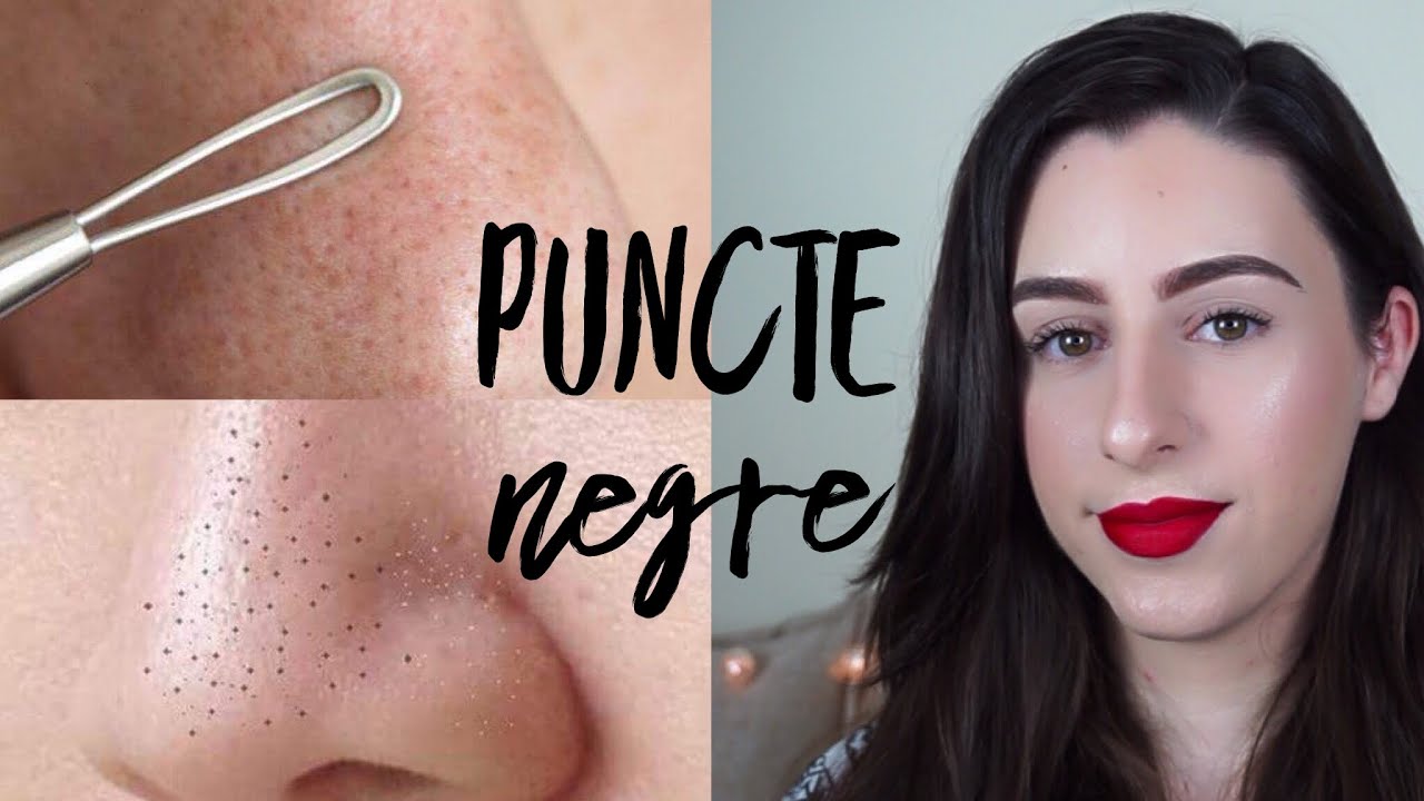 Punctele negre CAUZE si TRATARE | Alexandra Minghel - YouTube