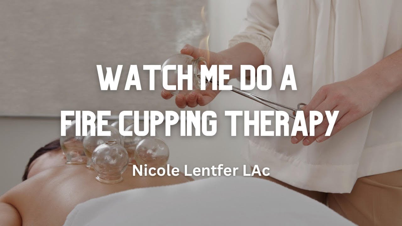 The 411 on Fire Cupping Therapy - YouTube