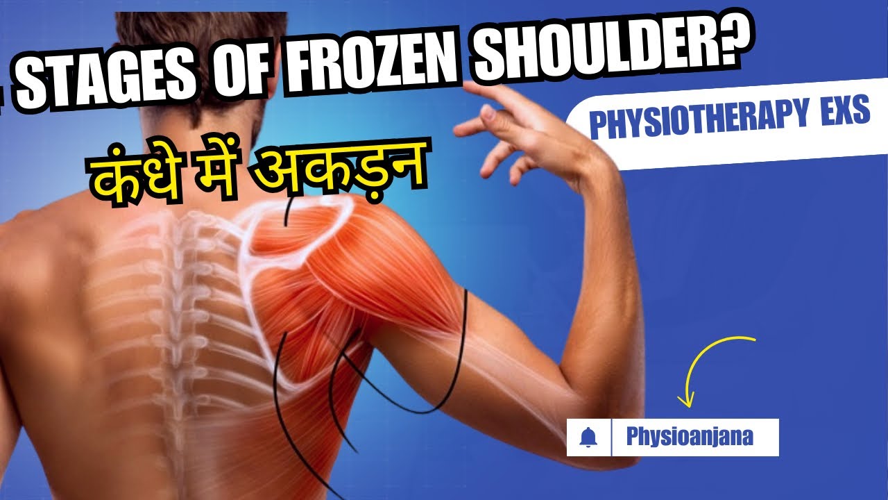 Frozen Shoulder Physiotherapy| Stages of Frozen Shoulder - YouTube